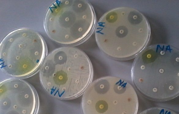 AUTOMATED SYSTEMS FOR BACTERIAL IDENTIFICATION AND ANTIBIOGRAM: VITEK 2 ...