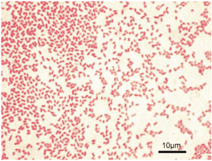 GRAM STAINING TECHNIQUE - Microbiology Class