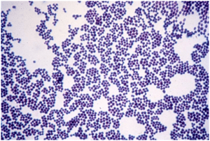 GRAM STAINING TECHNIQUE - Microbiology Class