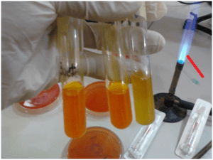 INOCULATION TECHNIQUE - Microbiology Class