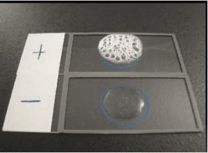 CATALASE TEST - Microbiology Class