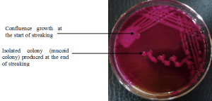 Colonial Morphology Of Microorganisms - Microbiology Class