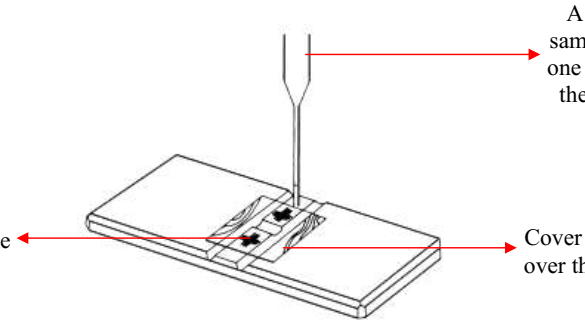 TRANSPEPTIDATION REACTION - Everything Microbiology