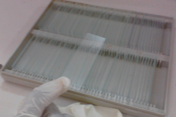 STAINING TECHNIQUE Archives - Everything Microbiology