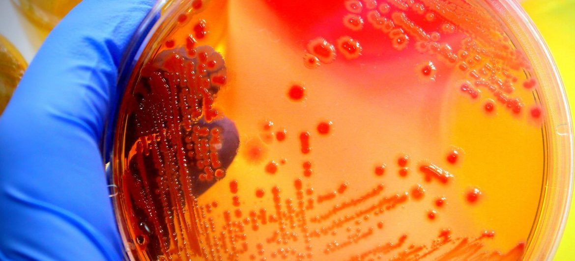 Overview of Microbiology - Everything Microbiology