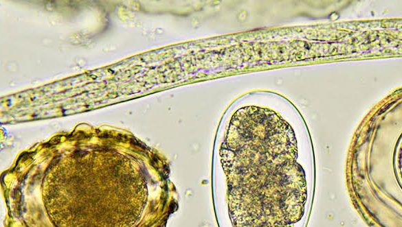 Public Health & Parasitic Diseases (Parasitology) – Everything Microbiology