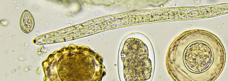 Classification of parasites that parasitize humans - #1 Microbiology ...