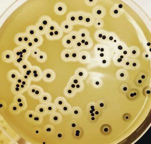 BAIRD–PARKER AGAR - Microbiology Class