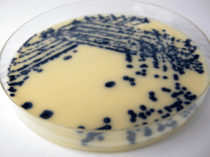 Vancomycin resistance in Enterococci - #1 Microbiology Resource Hub