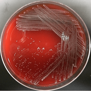 CORYNEBACTERIUM DIPHTHERIAE - Microbiology Class
