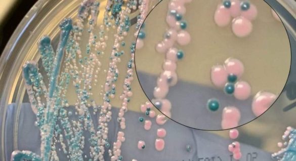 Candida glabrata - Everything Microbiology