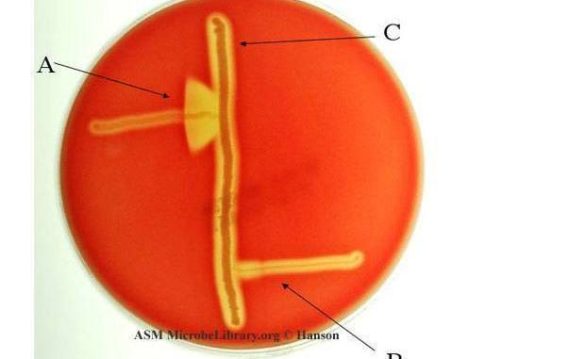 CAMP Test for Identification of Group B Streptococci - Everything ...