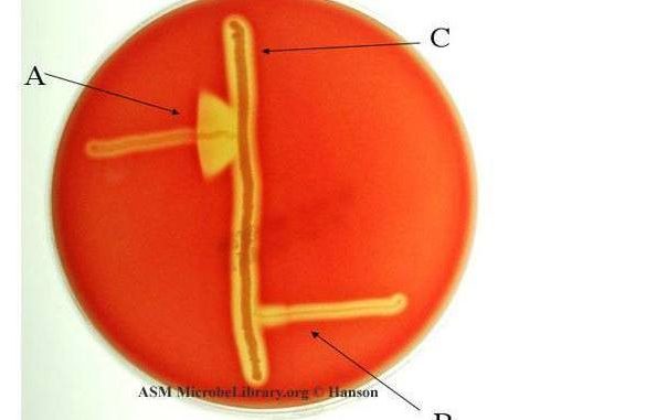 SATELLITISM TEST - Everything Microbiology