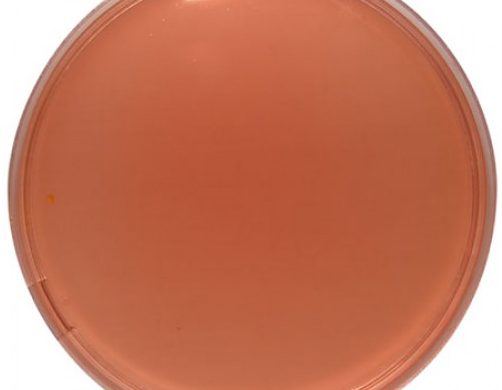 Culture media Archives - Everything Microbiology