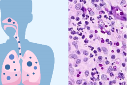 Limulus Amoebocyte Lysate (LAL) Test – Everything Microbiology