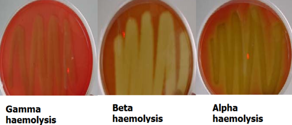 BLOOD AGAR HAEMOLYSIS TEST - Everything Microbiology