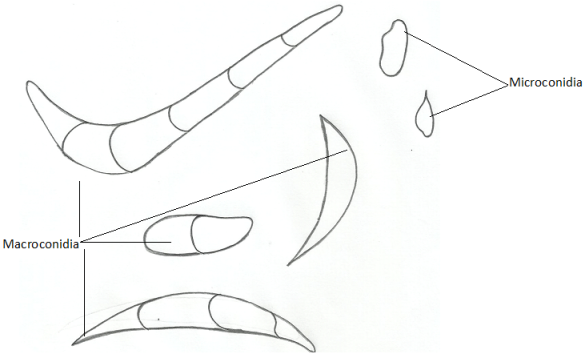 STRUCTURES OF FUNGI - Everything Microbiology