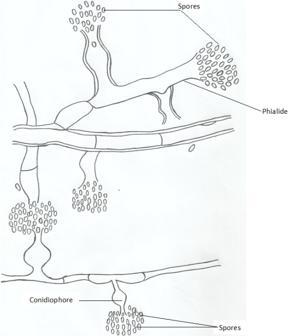 SUBCUTANEOUS MYCOSES - Everything Microbiology