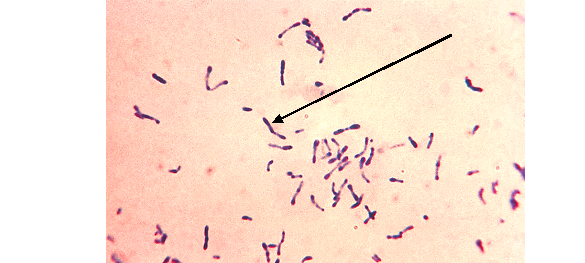 Buffered Charcoal Yeast Extract (BCYE) Agar - Everything Microbiology