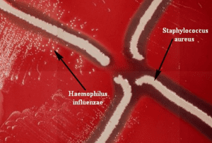 SATELLITISM TEST - Microbiology Class