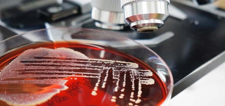 Collection And Processing Of Various Clinical Samples In The ...