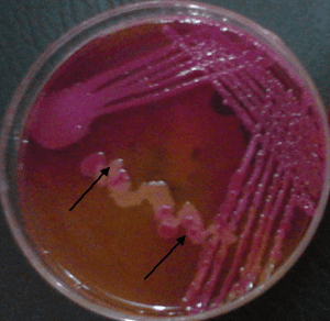 STOOL CULTURE TECHNIQUE - Microbiology Class