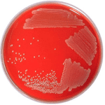 URINE CULTURE TECHNIQUE - Microbiology Class