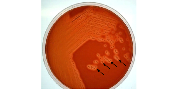 SPUTUM CULTURE TECHNIQUE - Everything Microbiology