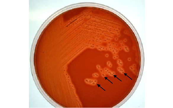 Specimen Collection in Microbiology Lab - Everything Microbiology