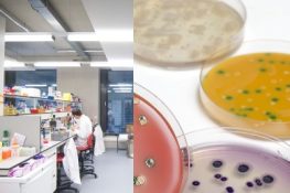 Specimen Collection in Microbiology Lab - Everything Microbiology