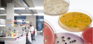 LABORATORY DIAGNOSIS OF FUNGAL INFECTIONS/DISEASES - Microbiology Class