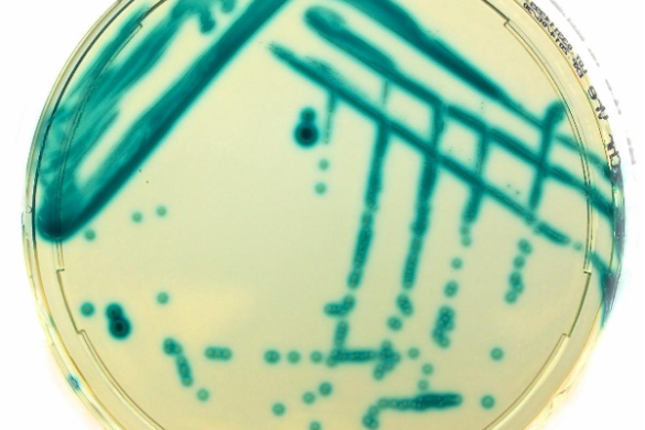 Desoxycholate Citrate Agar (DCA) - Everything Microbiology