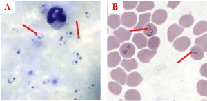 HUMAN PLASMODIUM SPECIES: Causative Agents Of Malaria - Microbiology Class