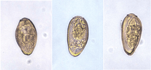 PARAGONIMIASIS - Microbiology Class
