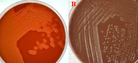 MEMBRANE FILTRATION TECHNIQUE - Everything Microbiology