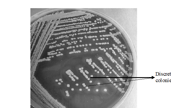 CLOSTRIDIUM BOTULINUM - Everything Microbiology