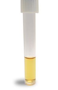 Selenite F Broth - Microbiology Class