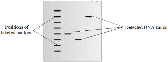 SOUTHERN BLOTTING TECHNIQUE - Everything Microbiology