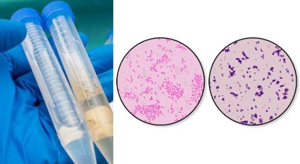 GRAM SMEAR OF CEREBROSPINAL FLUID (CSF) SAMPLE - Everything Microbiology