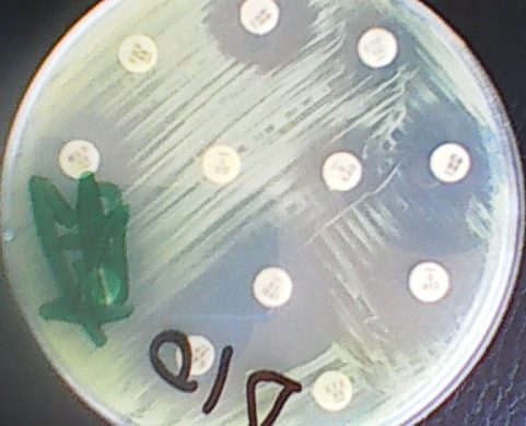 PREPARATION OF 0.5 McFARLAND TURBIDITY STANDARDS - Everything Microbiology