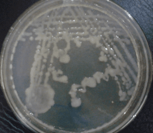 CULTURING TECHNIQUE - Microbiology Class