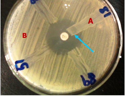 STREAKING TECHNIQUE - Everything Microbiology