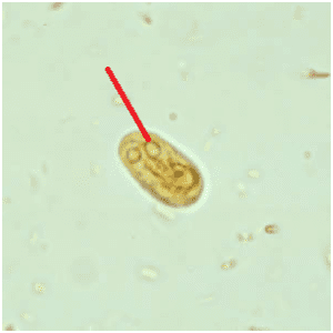 Giardiasis Microbiology Class