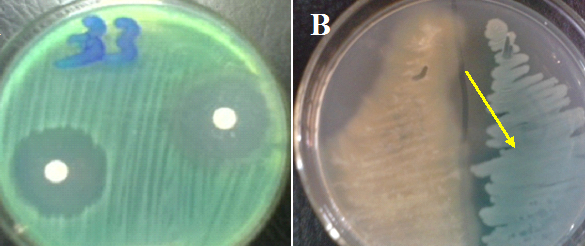 ISOLATION TECHNIQUE - Everything Microbiology