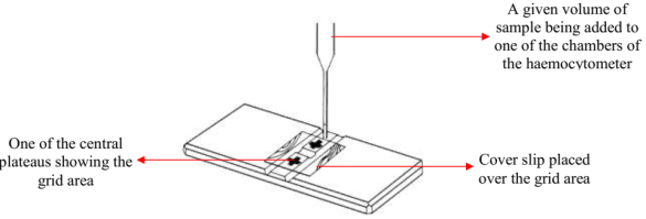 HAEMOCYTOMETER CELL COUNT FOR CSF SAMPLE - Everything Microbiology