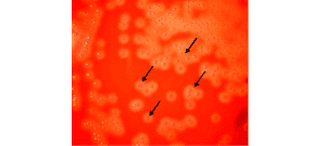 STREPTOCOCCUS PYOGENES - Microbiology Class