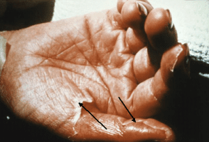 STAPHYLOCOCCUS AUREUS - Microbiology Class