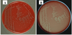 LISTERIA MONOCYTOGENES - Microbiology Class